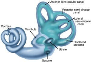 Crystals And Vertigo Ear